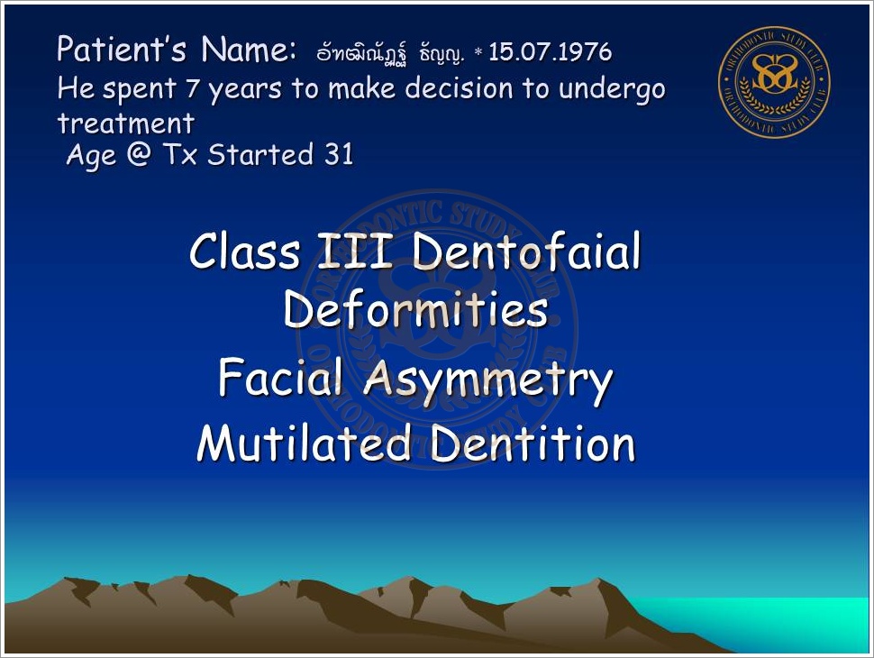 Adult Treatment of severe dental & skeletal Class III malocclusion ...