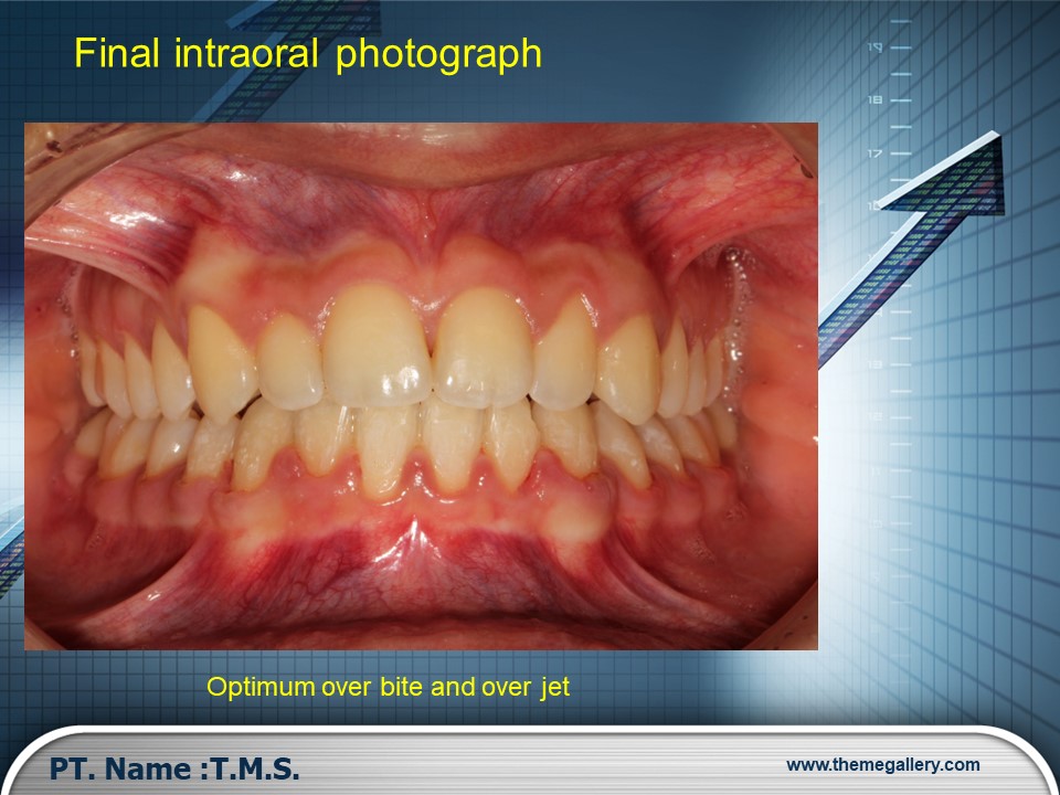 THOMAS, MAYA STELLA CLASS II - Orthodontic and TMD Center